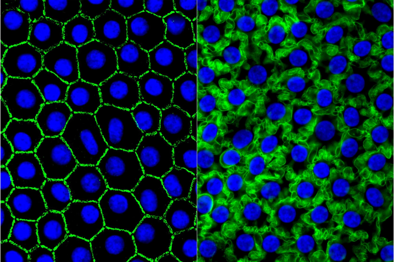 BiiGC-8-Double-faces-of-corneal-endothelial-cells - Deutsche ...